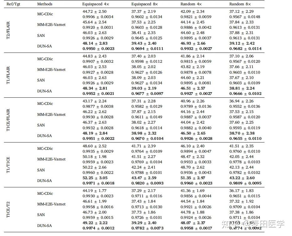 用于多模态MRI重建的具有空间对齐的深度展开网络|文献速递--基于多模态-半监督深度学习的病理学诊断与病灶分割 - 知乎