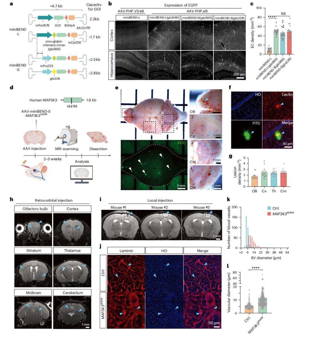Nat Biomed Eng|戈鹉平/孙文智开发rAAV-miniBEND系统：破解脑内皮细胞基因递送难题，助力脑血管畸形建模！ - 知乎