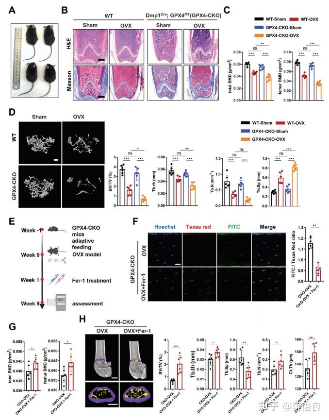 文献60-骨细胞铁死亡是绝经后骨质疏松的潜在治疗靶点 - 知乎