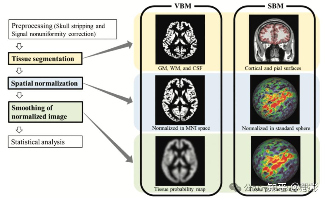 使用VBM和SBM在皮质形态分析中的优势 - 知乎