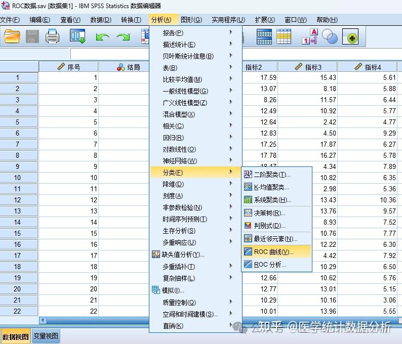 分别用SPSS和R语言演示ROC曲线的画法 - 知乎