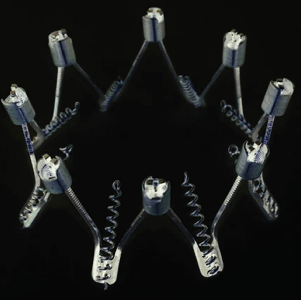 三尖瓣反流丨经导管 瓣环成形术修复器械 - 知乎