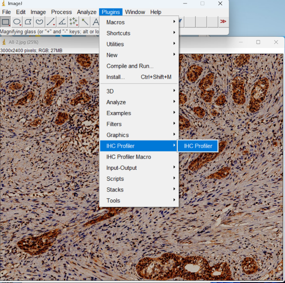 解忧小工具｜保姆式教程！用Image J进行免疫组化分析（IHC score评分） - 知乎