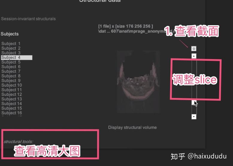 CONN使用总结1 (resting-state fMRI) - 知乎