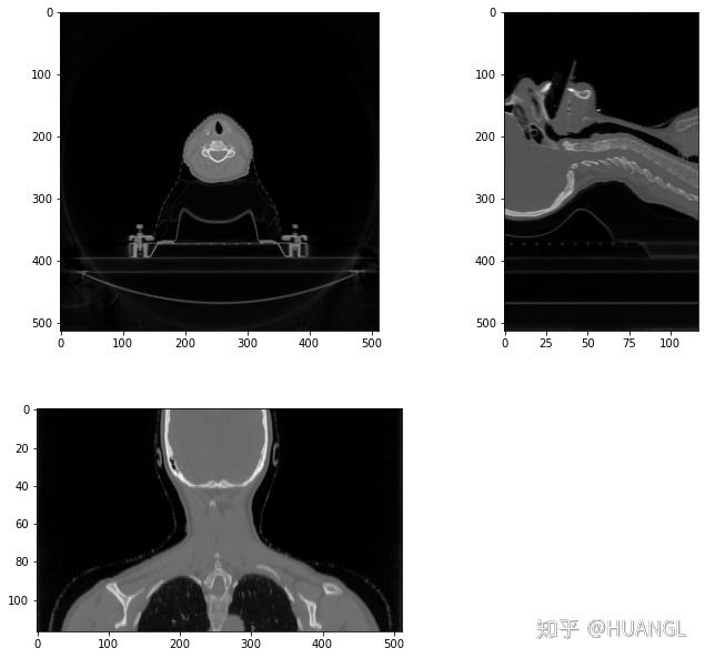 利用Python绘制 CT三视图 - 知乎