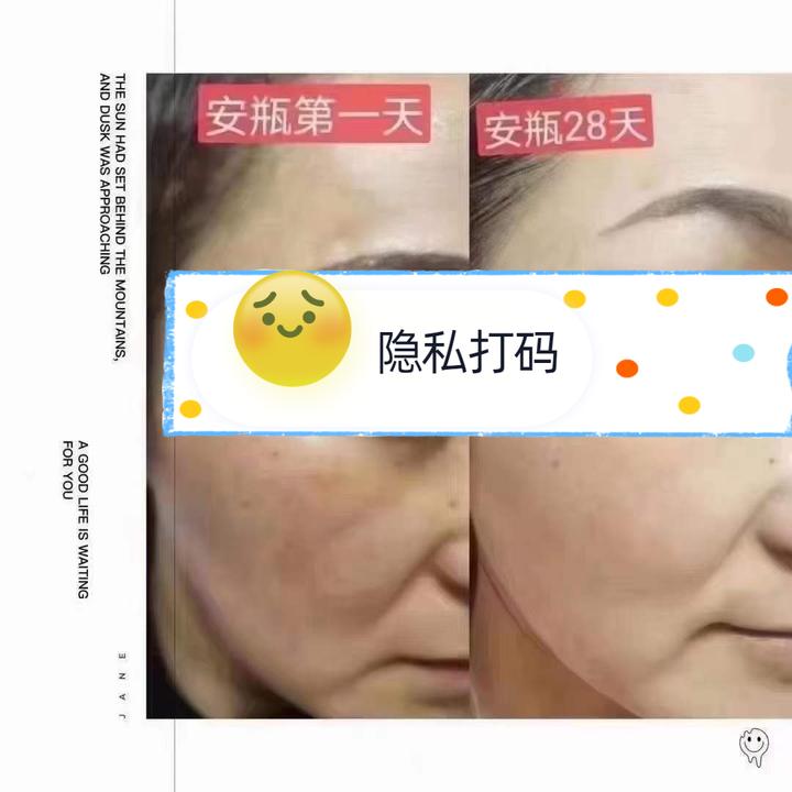 有效的美白去黄护肤品 知乎