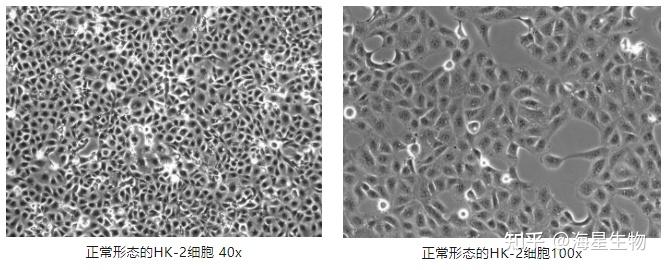 HK-2细胞培养常见问题与技巧 - 知乎