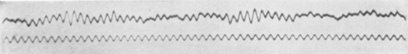 神经振荡（Neural oscillation）：神经活动的节奏和韵律 - 知乎