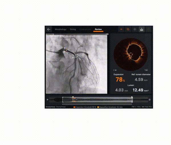 CCEC·前沿技术｜当人工智能“预见”OCT - 知乎