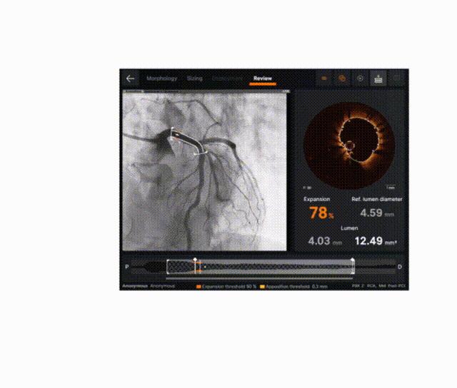 CCEC·前沿技术｜当人工智能“预见”OCT - 知乎