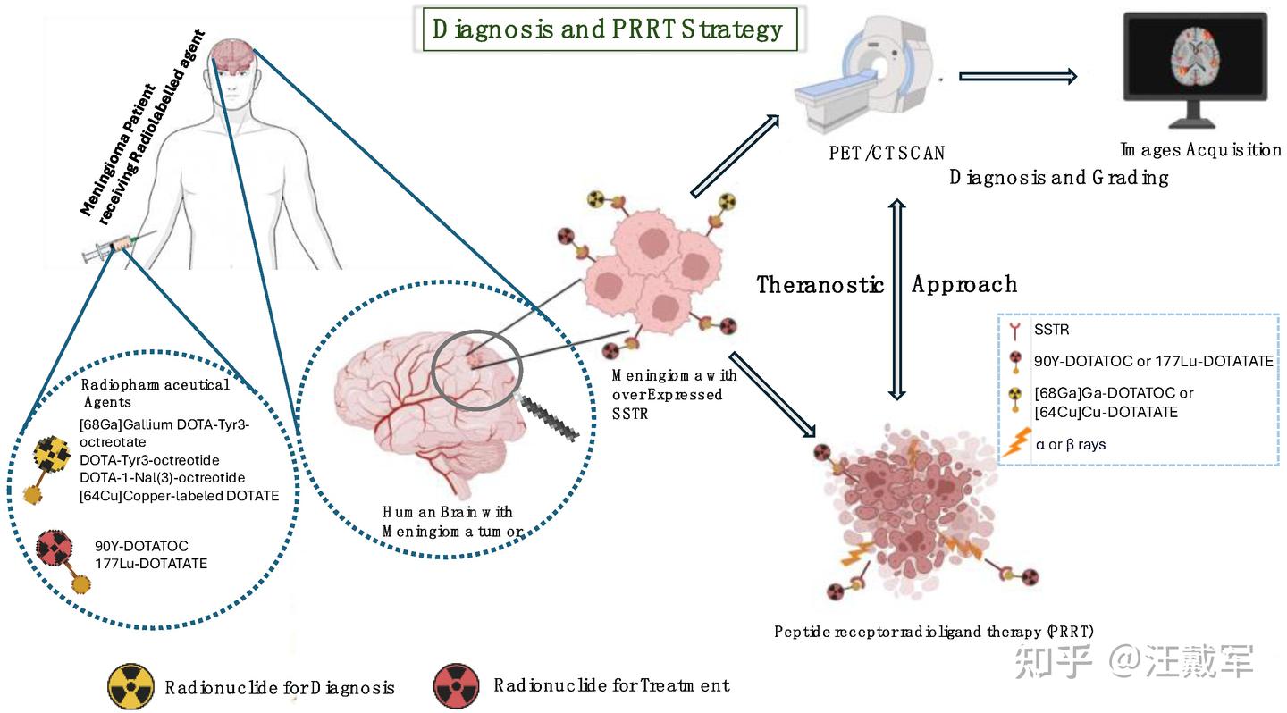 DOTA肽PET成像技术与放射性配体在脑膜瘤诊断、治疗中的应用 - 知乎