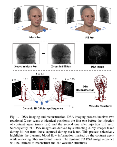 Angiotool 血管参数分析软件 - 知乎