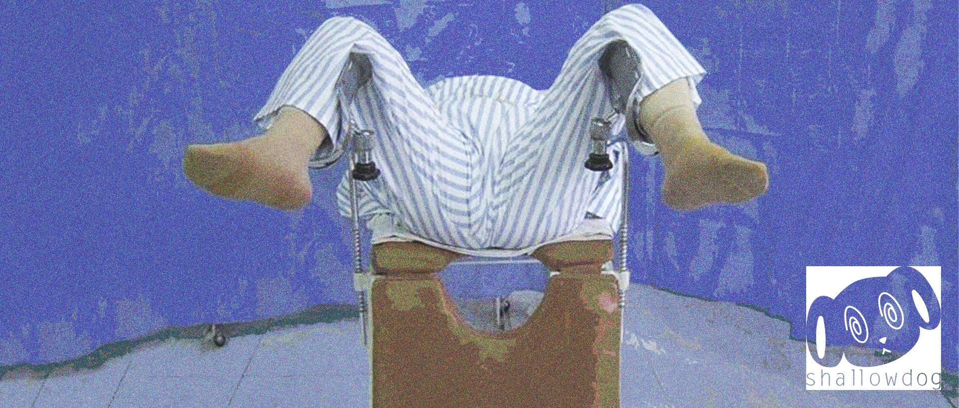 痔疮手术是当代男性的割礼 知乎