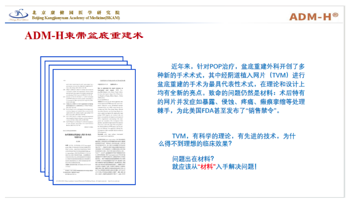 焕发少女活力！ADM-H盆底重建术助你重建自信！ - 知乎