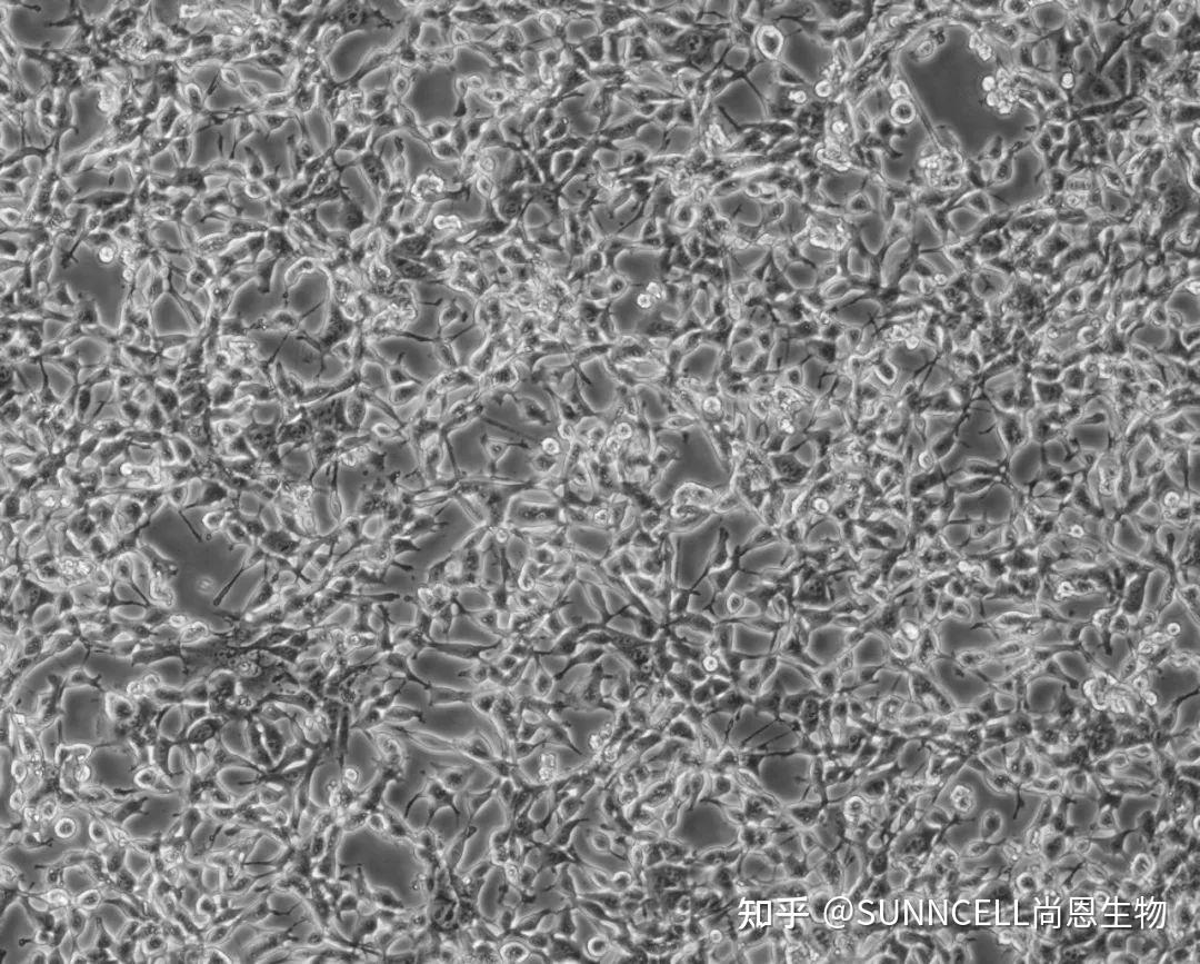CT26.WT(小鼠结肠癌细胞)培养教程 - 知乎