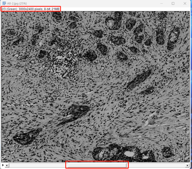 解忧小工具｜保姆式教程！用Image J进行免疫组化分析（IHC score评分） - 知乎