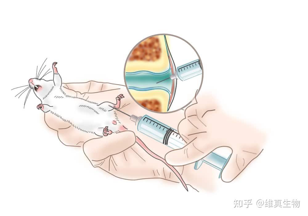 AAV骨关节注射的操作方法具体是什么？ - 知乎