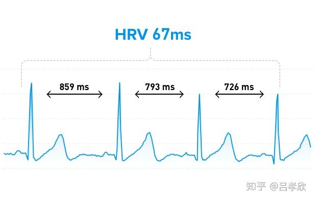 您需要了解的有关心率变异性（HRV）的一切 - 知乎