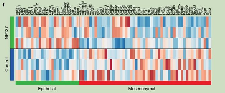 Netrin-1阻断能抑制子宫内膜癌的肿瘤生长和EMT特征 - 知乎