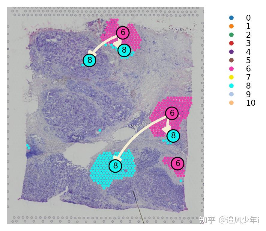 10X单细胞空间回顾之stlearn - 知乎
