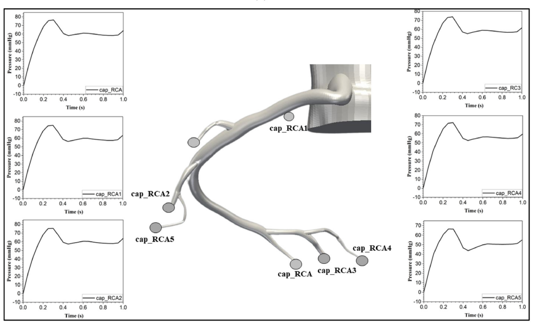 SimVascular参数计算 - 知乎