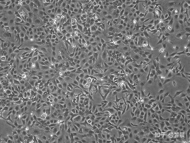 SK-OV-3细胞培养攻略 - 知乎
