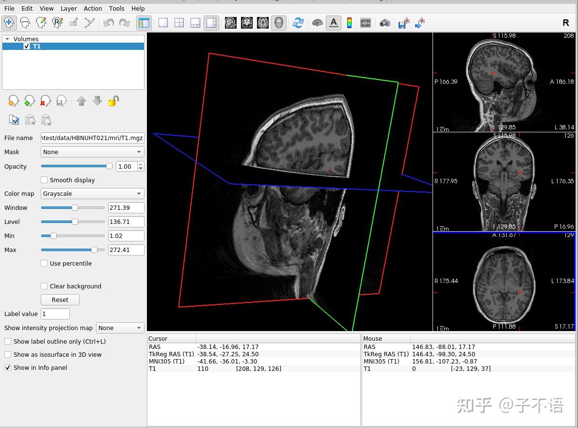 freesurfer全过程梳理 - 知乎