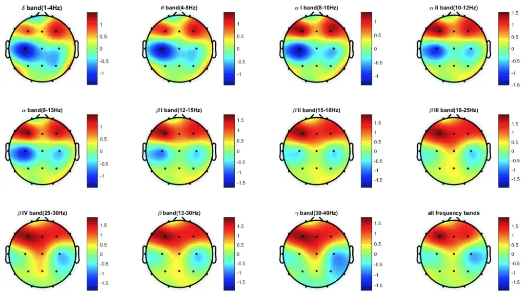 MATLAB脑电数据处理精要（一、概述） - 知乎