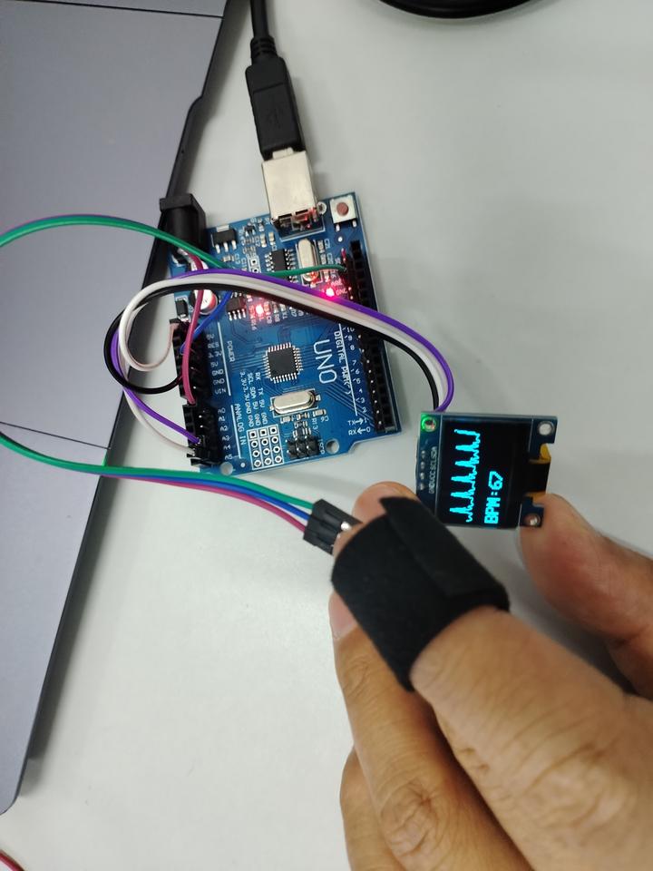 Arduino UNO驱动OLED屏幕显示Pulse Sensor传感器心率波形和数值 PC端Procesing软件显示PPG波形和脉搏数值 - 知乎