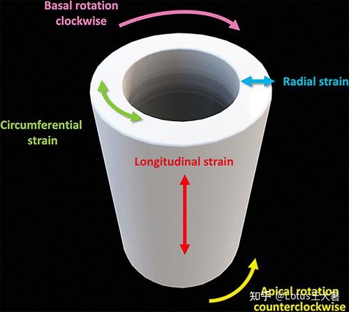 #151 2023年心脏CT的最新进展Radiology综述解读：心肌应变基础 - 知乎