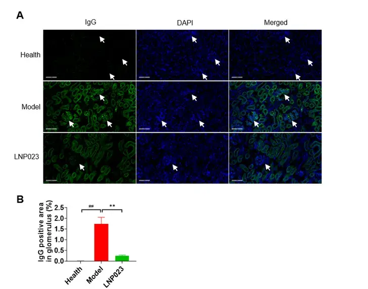 膜性肾病的发病机制、治疗进展及动物模型 - 知乎