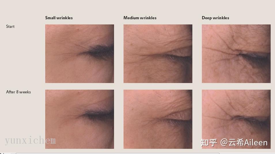 三肽-2(Tripeptide-2)如何应用 - 知乎