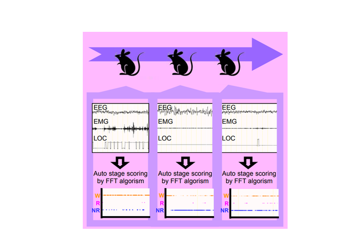 SleepSign 睡眠分析系统 - 知乎