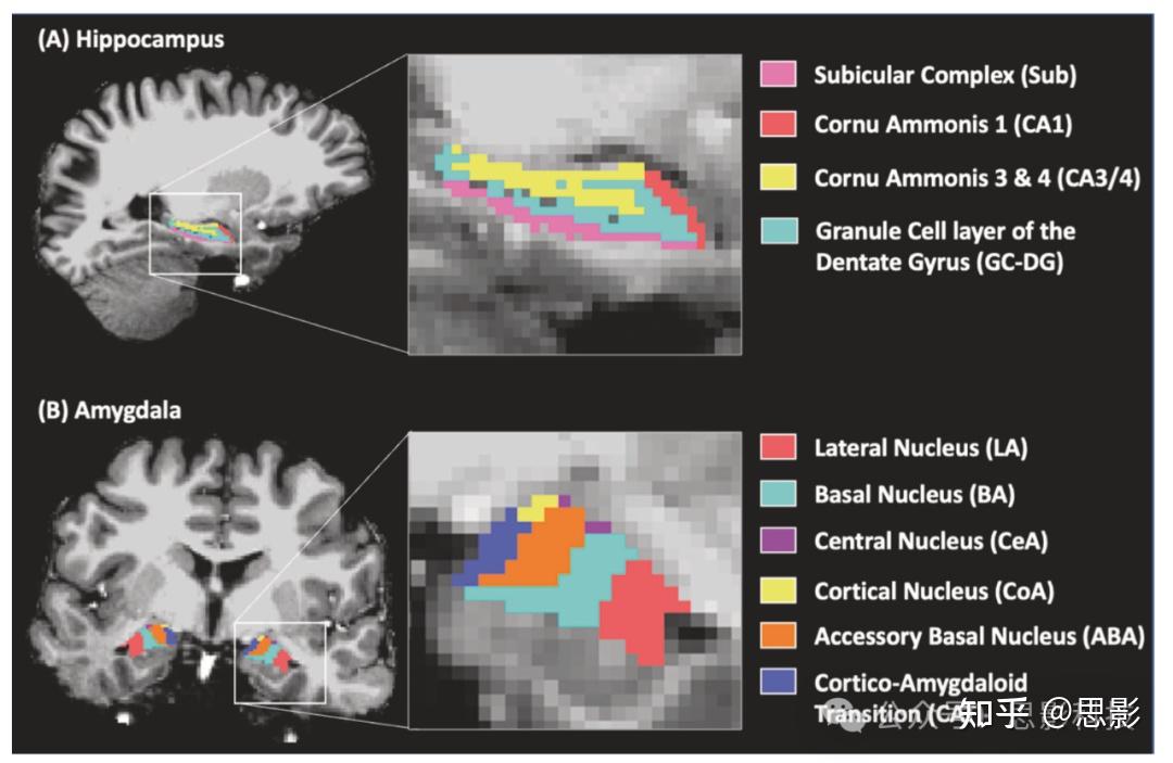 重性抑郁症患者海马与杏仁核亚区连接组层级的改变 - 知乎