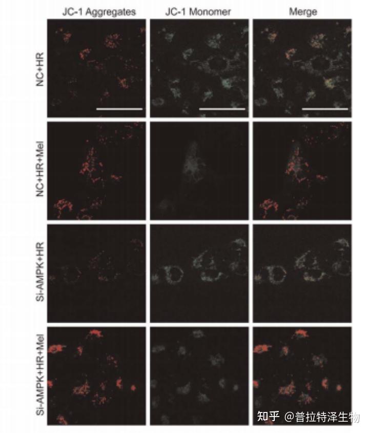 手把手教学｜使用JC-1荧光探针检测贴壁细胞线粒体膜电位变化 - 知乎