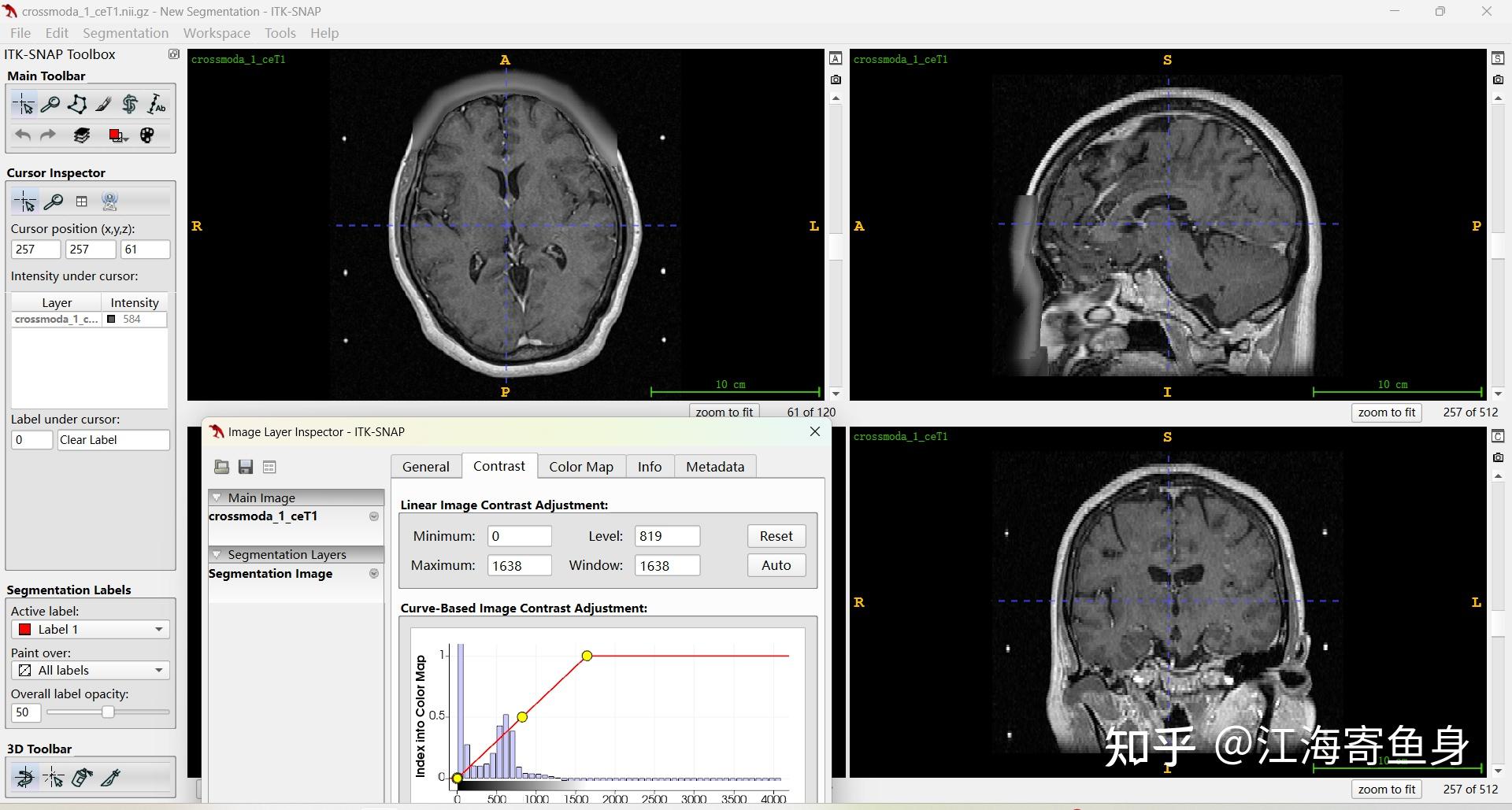 [项目实战]基于CycleGAN的MRI跨模态图像翻译（一）图像切分和数据集划分 - 知乎