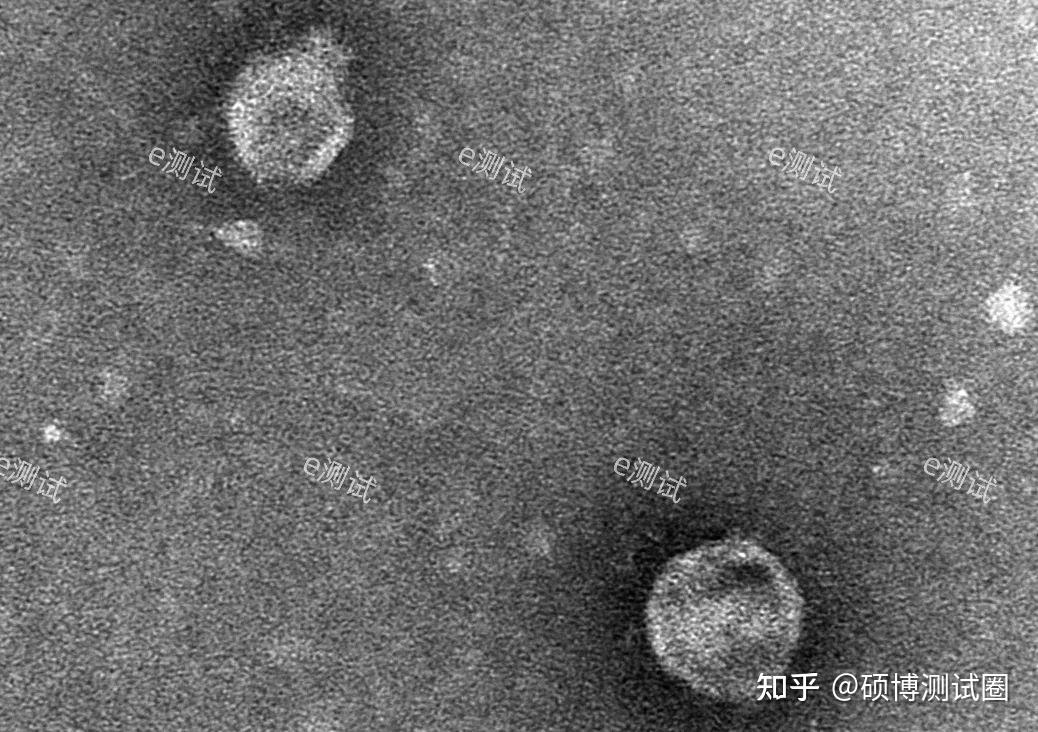 生物干货| 透射电镜之负染色技术 - 知乎