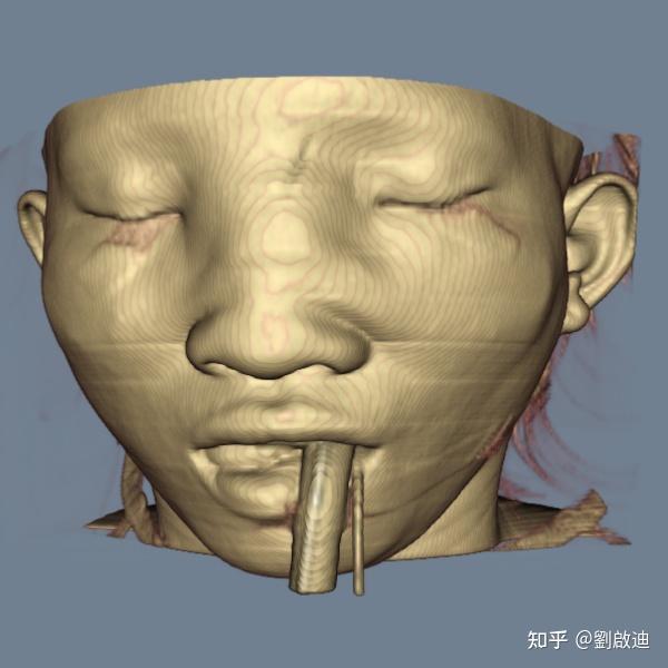 VTK-20. Volume Rendering 體數據渲染 - 知乎