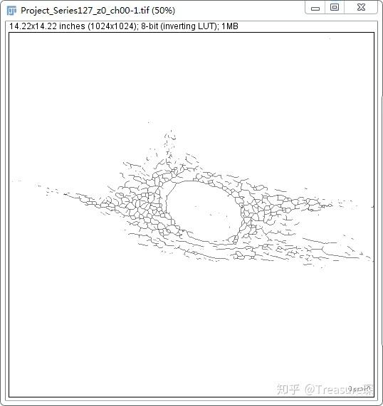 ImageJ实用技巧——线粒体网络形态分析(插件篇) - 知乎