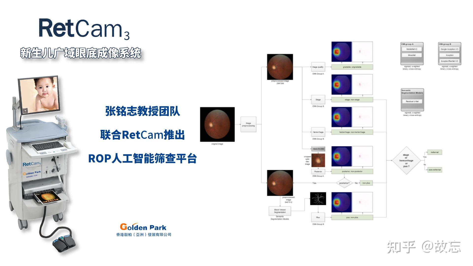 新生儿眼底检查系统 RetCam 结合人工智能 ROP 筛查平台 - 知乎