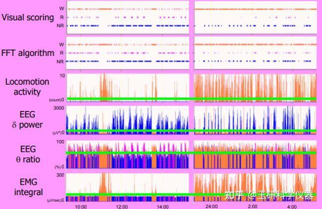 SleepSign 睡眠分析系统 - 知乎