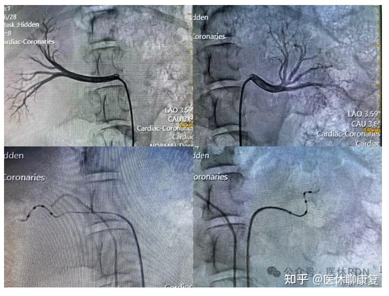 国产第3家，百心安RDN系统获批！ - 知乎