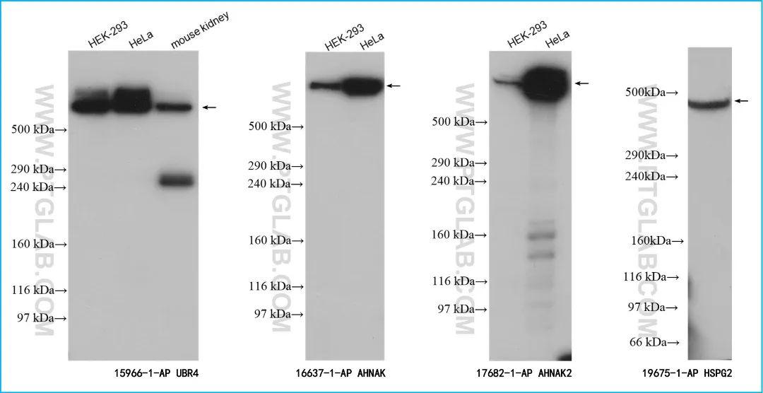 WB指南 | 大分子WB很难？手把手教学来啦！ - 知乎