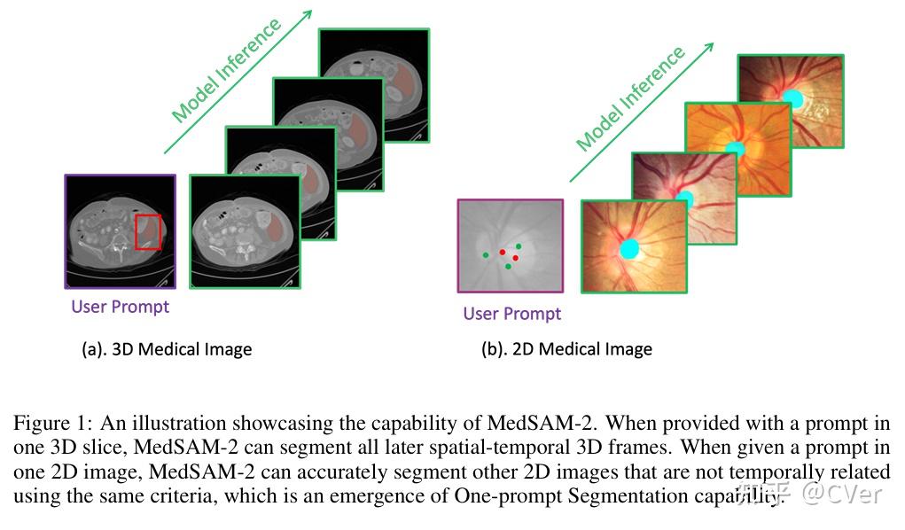 Medical Sam 2：基于sam 2的2d 3d医学图像分割 知乎