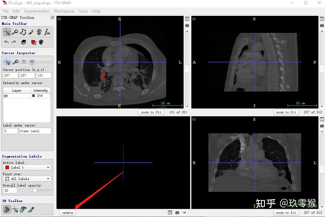 医学图像2D/3D可视化 ITK-SNAP软件使用 - 知乎