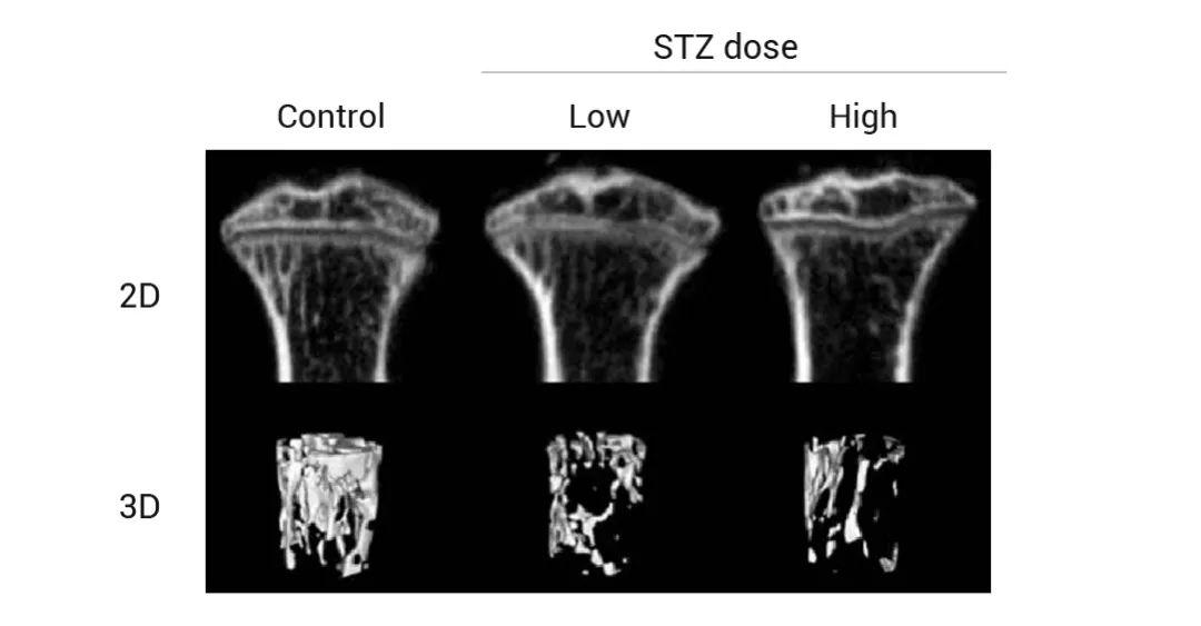 STZ 糖尿病造模保姆级教程！| MedChemExpress - 知乎