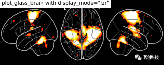 Nilearn：绘制大脑图像 - 知乎