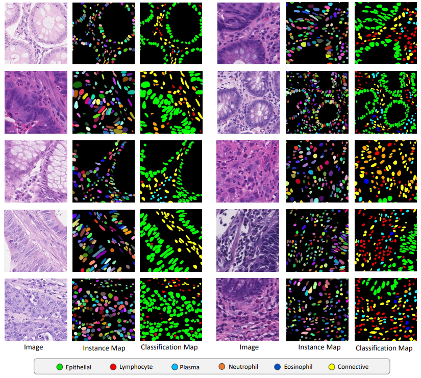 CoNIC2022 数据集介绍 - 知乎