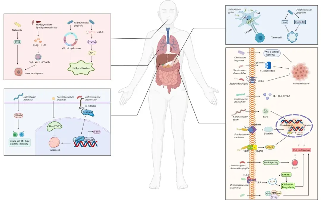Mol Cancer|Sinan Wang团队综述自噬和微生物群在癌症进展中的相互作用 - 知乎