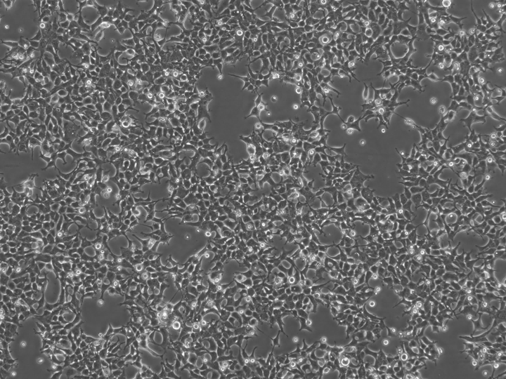 【细胞小讲堂】HEK293 细胞系：现代细胞研究和生物技术的基石，全面剖析：特点、应用、培养方法与研究进展 - 知乎